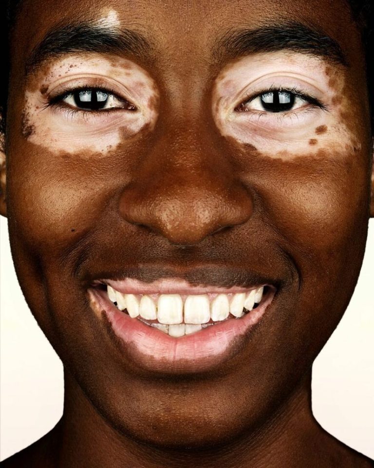 20 Stunning Portraits Celebrating the Beauty of Unique and Diverse People