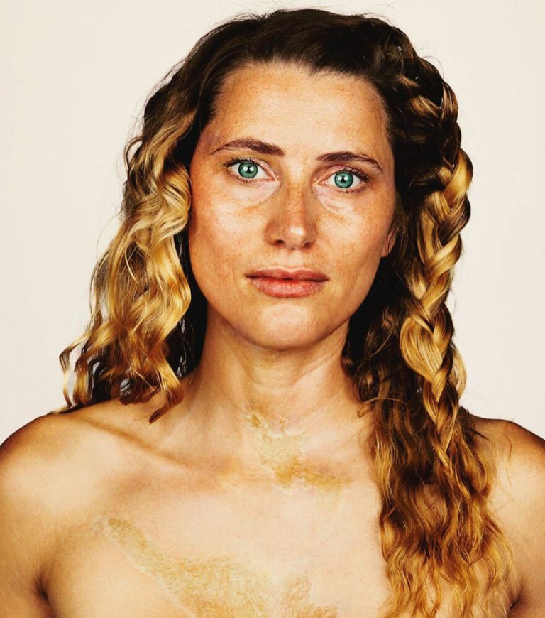 20 Stunning Portraits Celebrating the Beauty of Unique and Diverse People