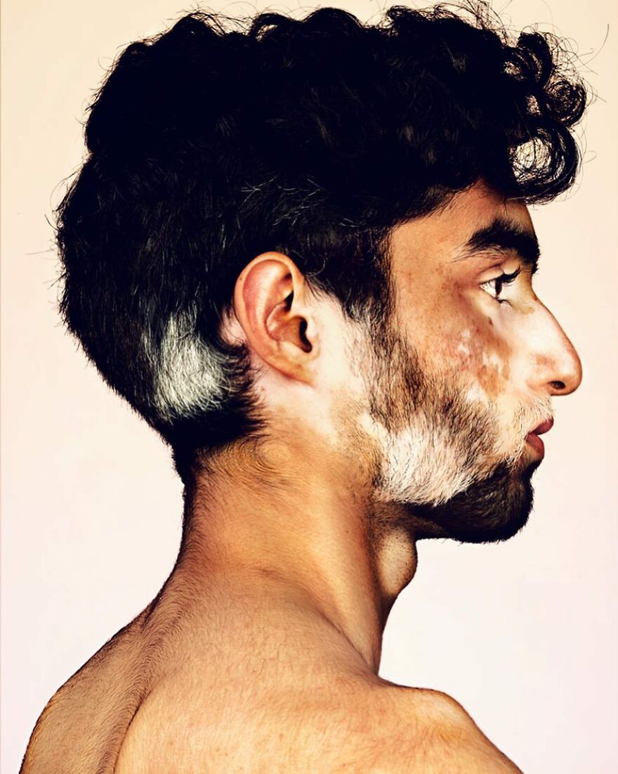 20 Stunning Portraits Celebrating the Beauty of Unique and Diverse People