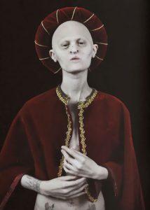 Meet Melanie Gaydos, a model 28 with a rare genetic disorder that ...